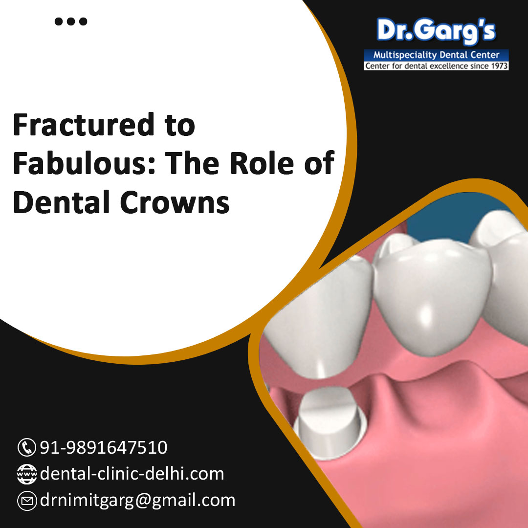 From Fractured to Fabulous: The Role of Dental Crowns